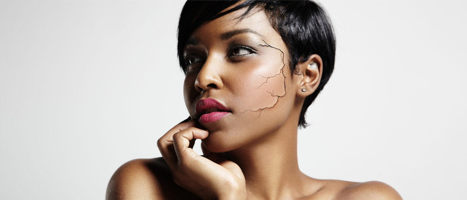 How To Care For Your Dry Skin - Cuticura